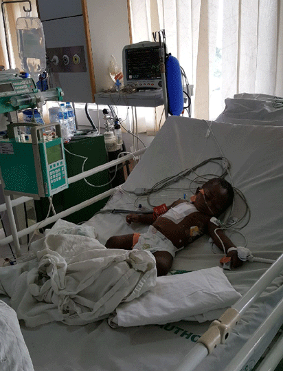 OAUTHC carries out successful paediatric open heart surgeries ...