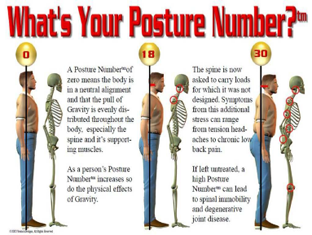 BAD POSTURE: Worse than a bad temper - Vanguard News