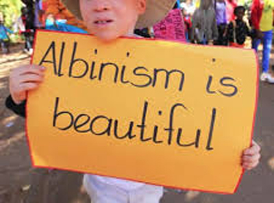NGO educates teachers on inclusive education for children with albinism